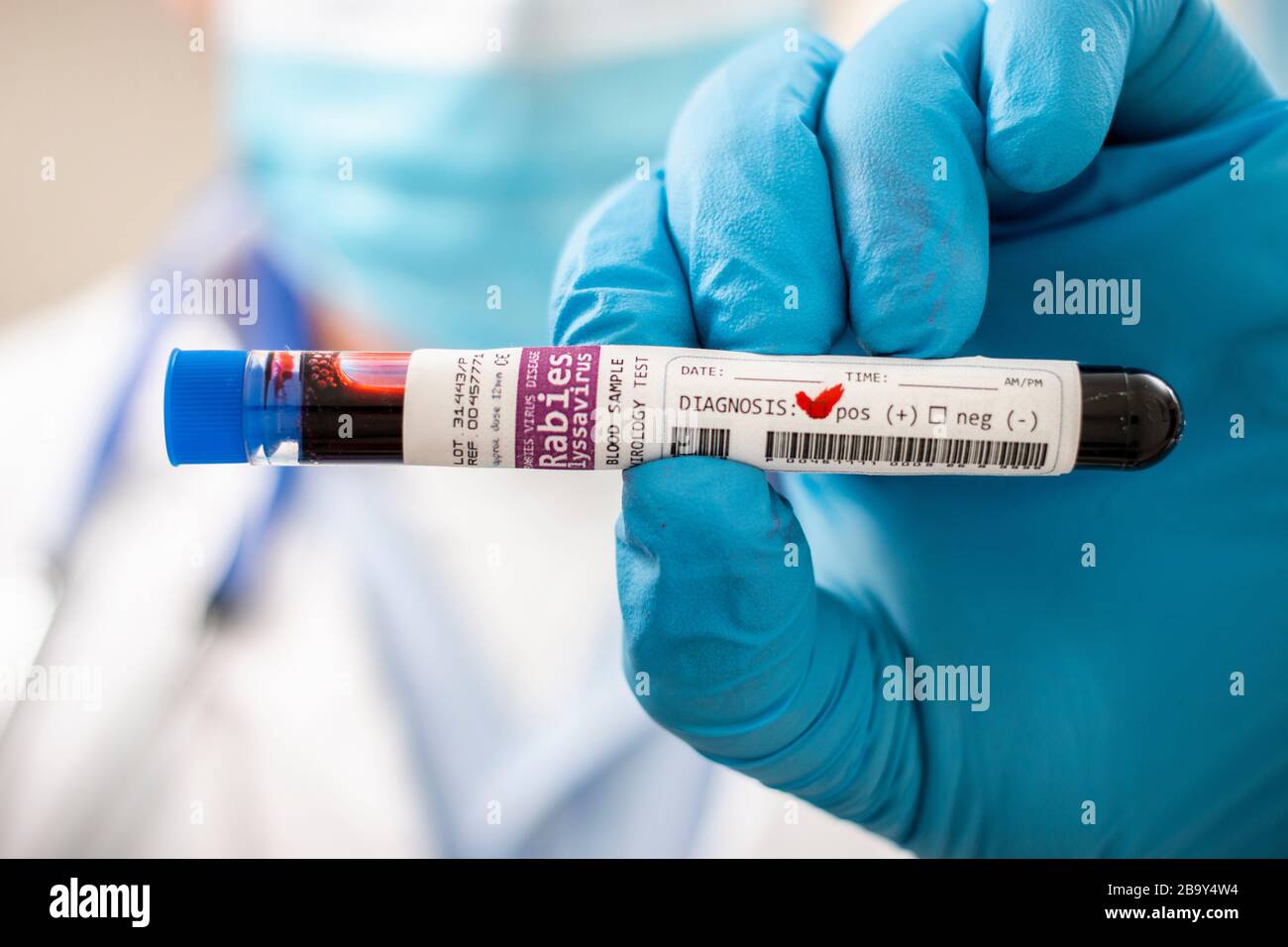 View of a doctor holding a fictional test tube blood sample, infected ...