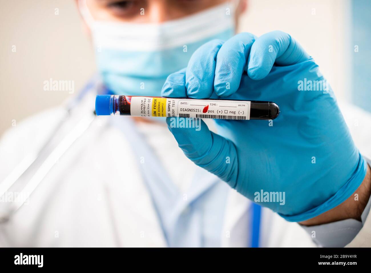 View of a doctor holding a fictional test tube blood sample, infected ...