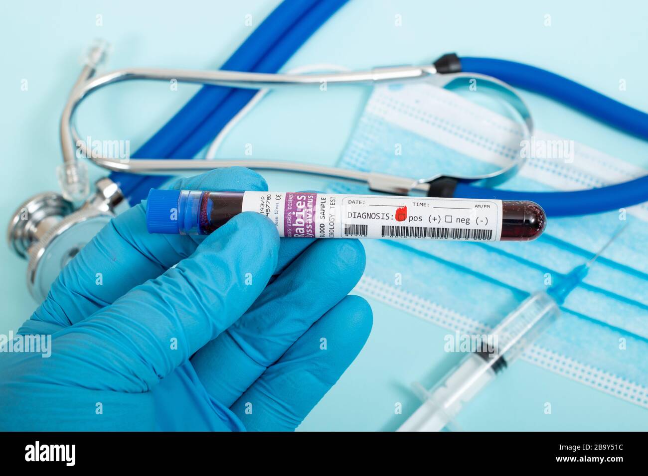 Fictional Blood samples with infected Rabies virus, with stethoscope ...