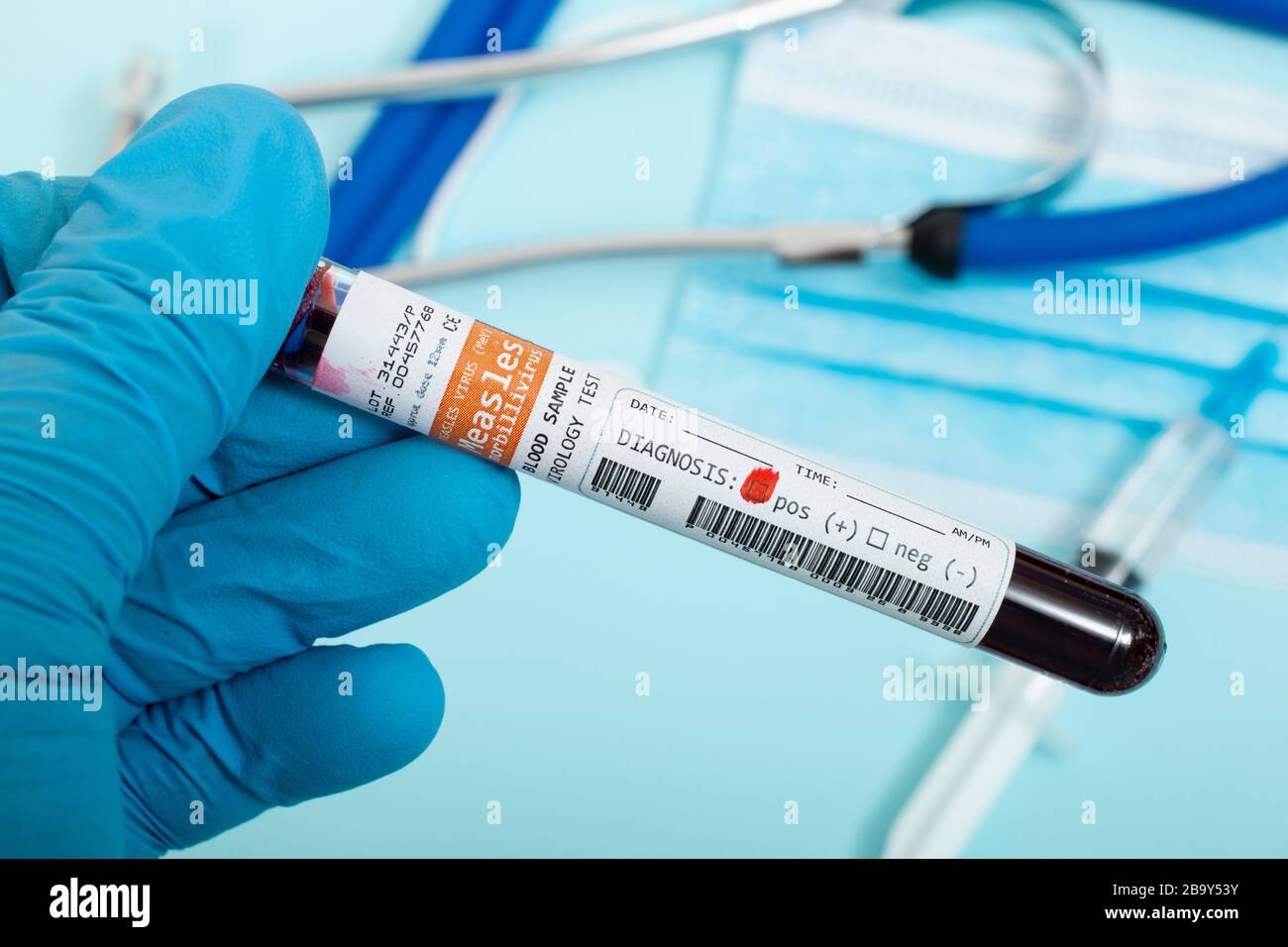 Fictional Blood samples with infected measles virus, with stethoscope ...