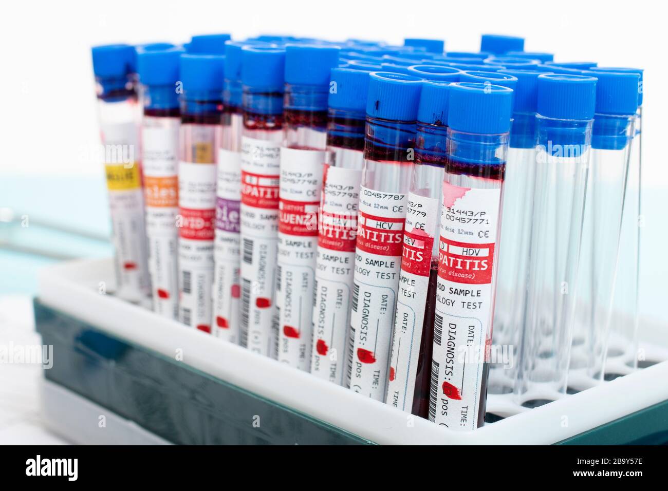 Blood samples in a test tube rack hi-res stock photography and images ...