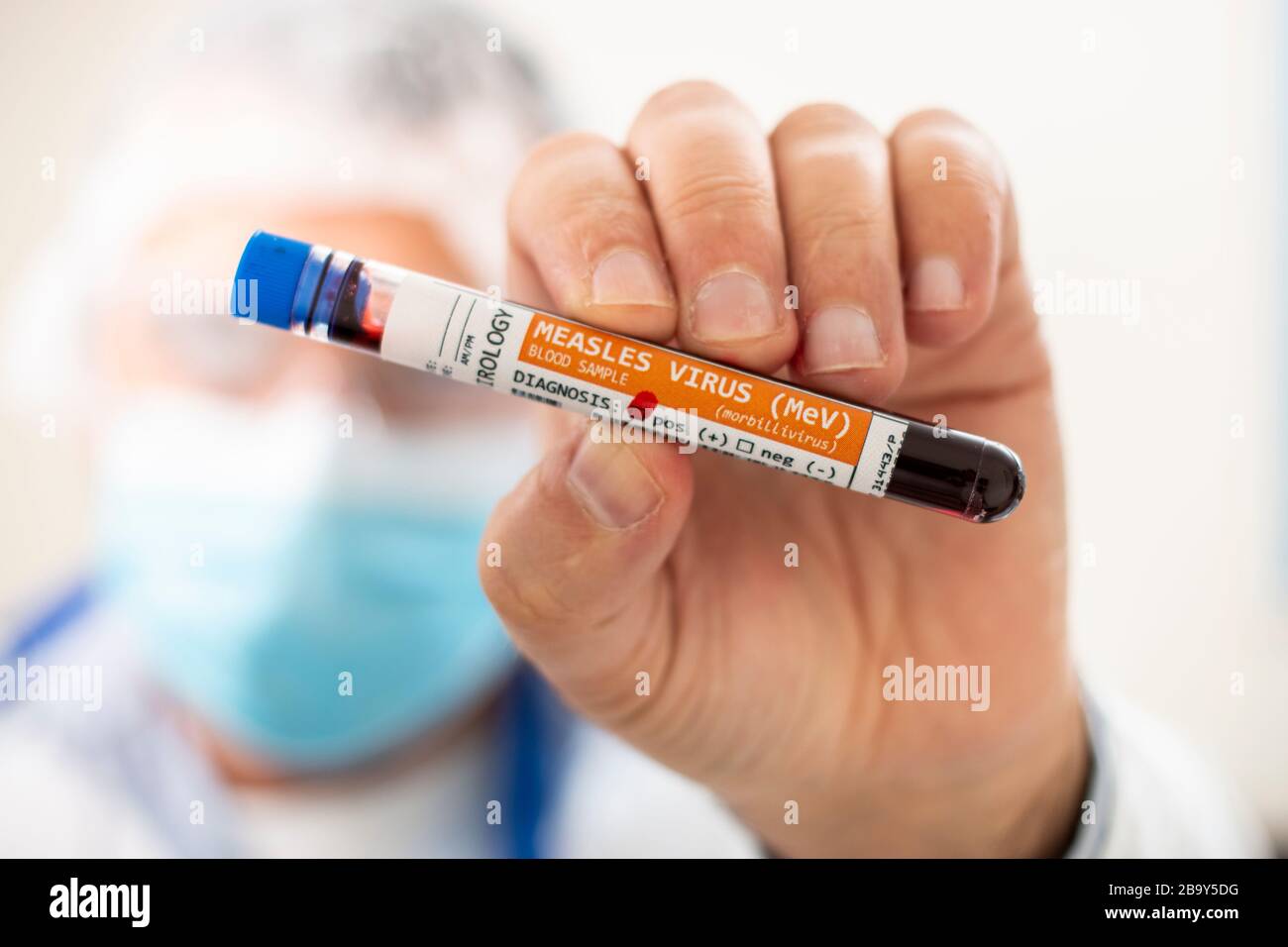 View of a doctor holding a fictional test tube blood sample, infected ...