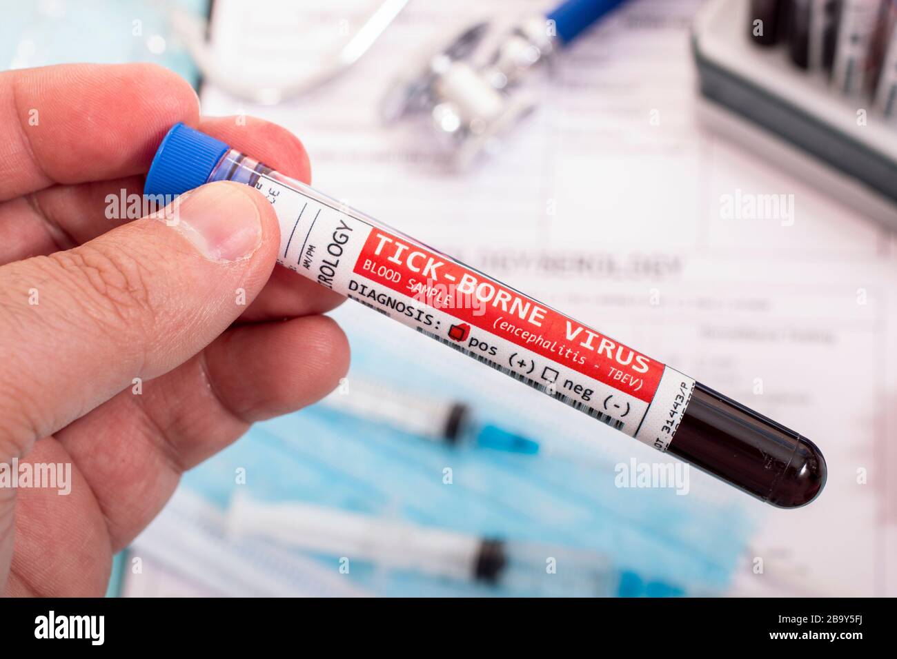 Fictional Blood samples with infected tick-borne virus, with ...