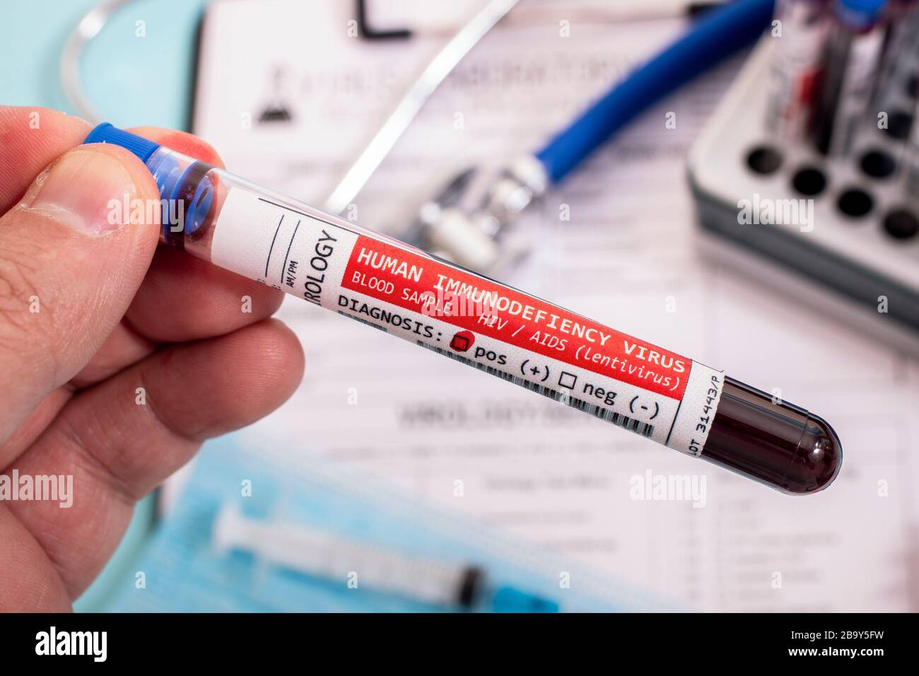 Fictional Blood samples with infected HIV/AIDS virus, with stethoscope ...