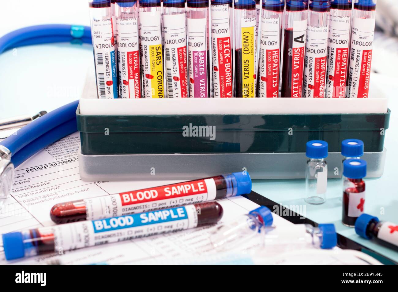 Several fictional infected blood samples with various virus on a vial ...