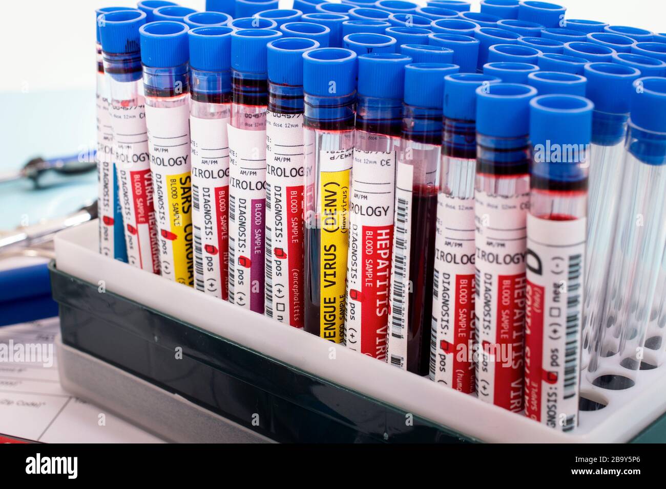 Several fictional infected blood samples with various virus on a vial ...