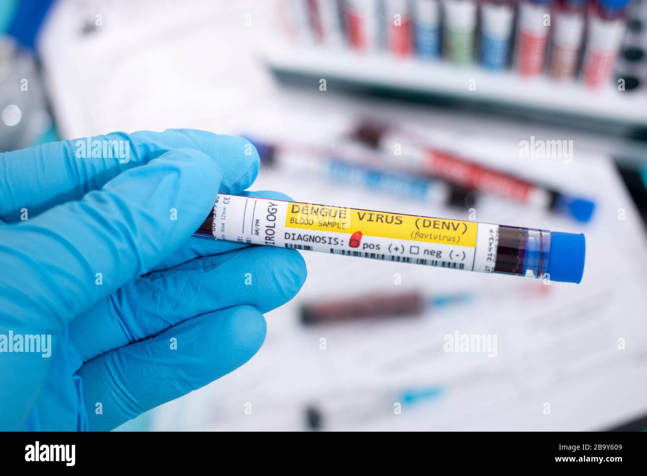 Fictional Blood samples with infected dengue virus, with stethoscope ...