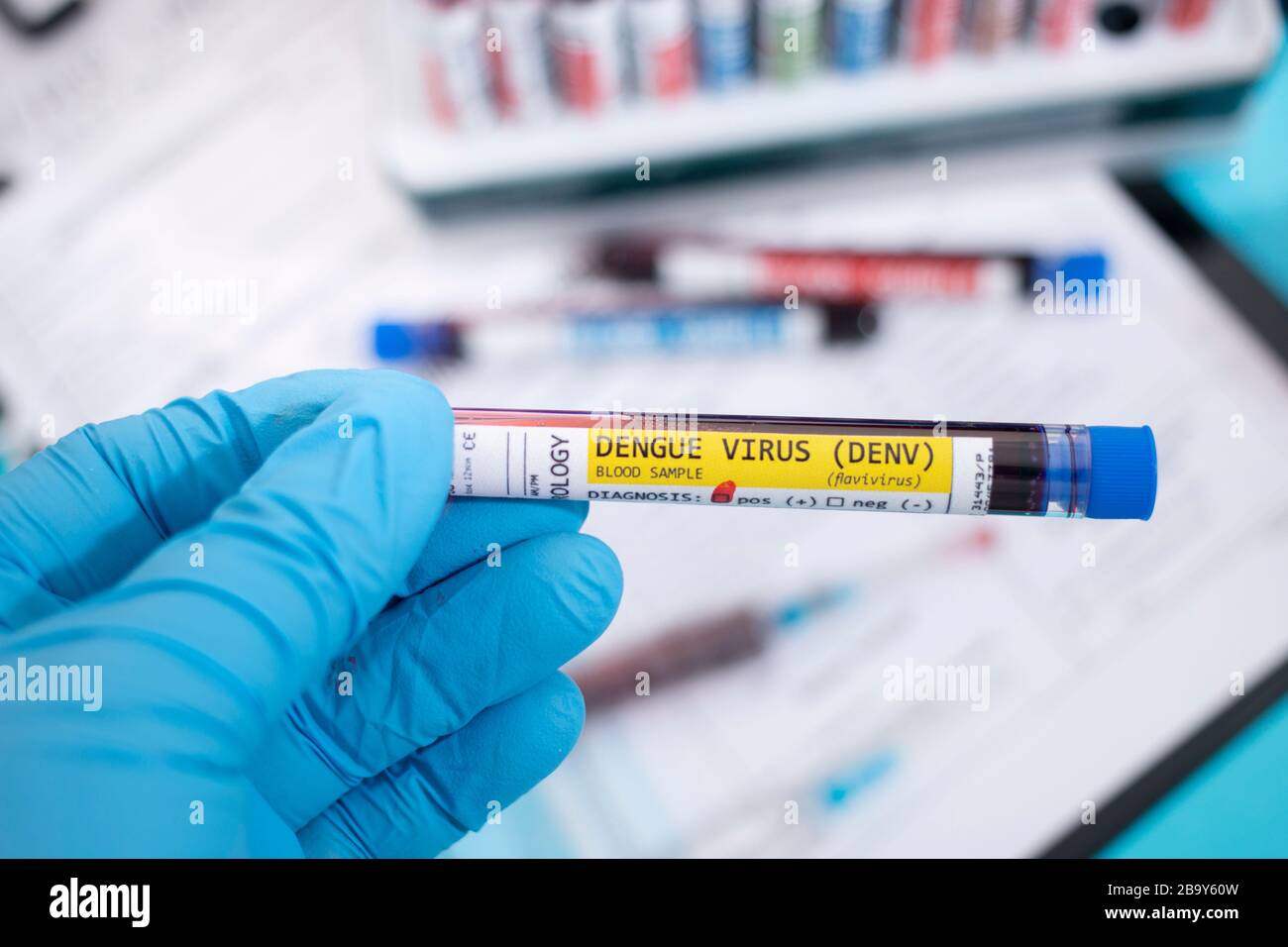 Fictional Blood samples with infected dengue virus, with stethoscope ...