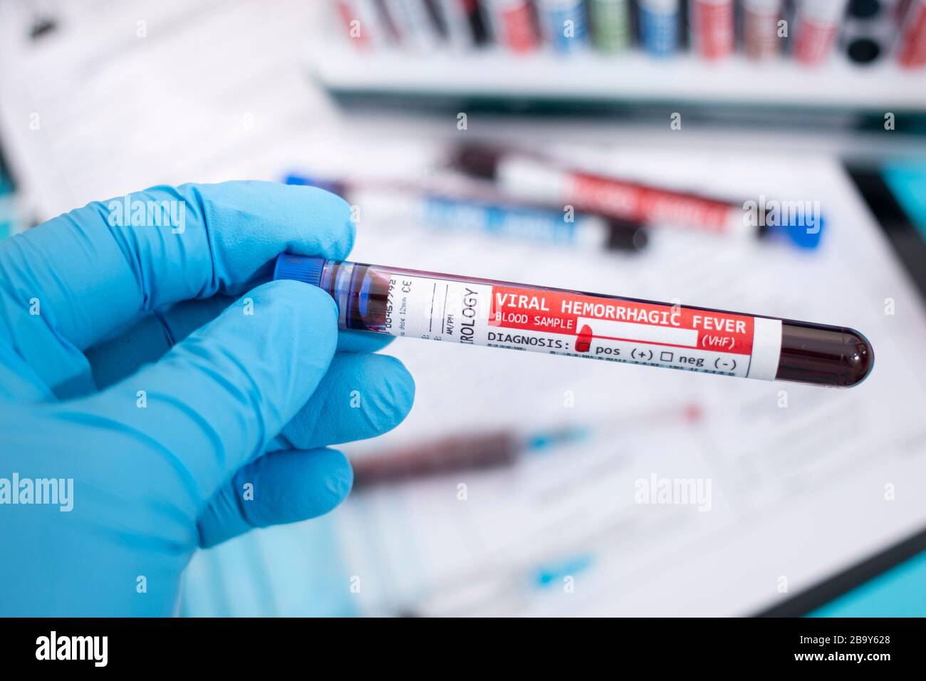 Fictional Blood samples with infected viral hemorrhagic fever virus ...
