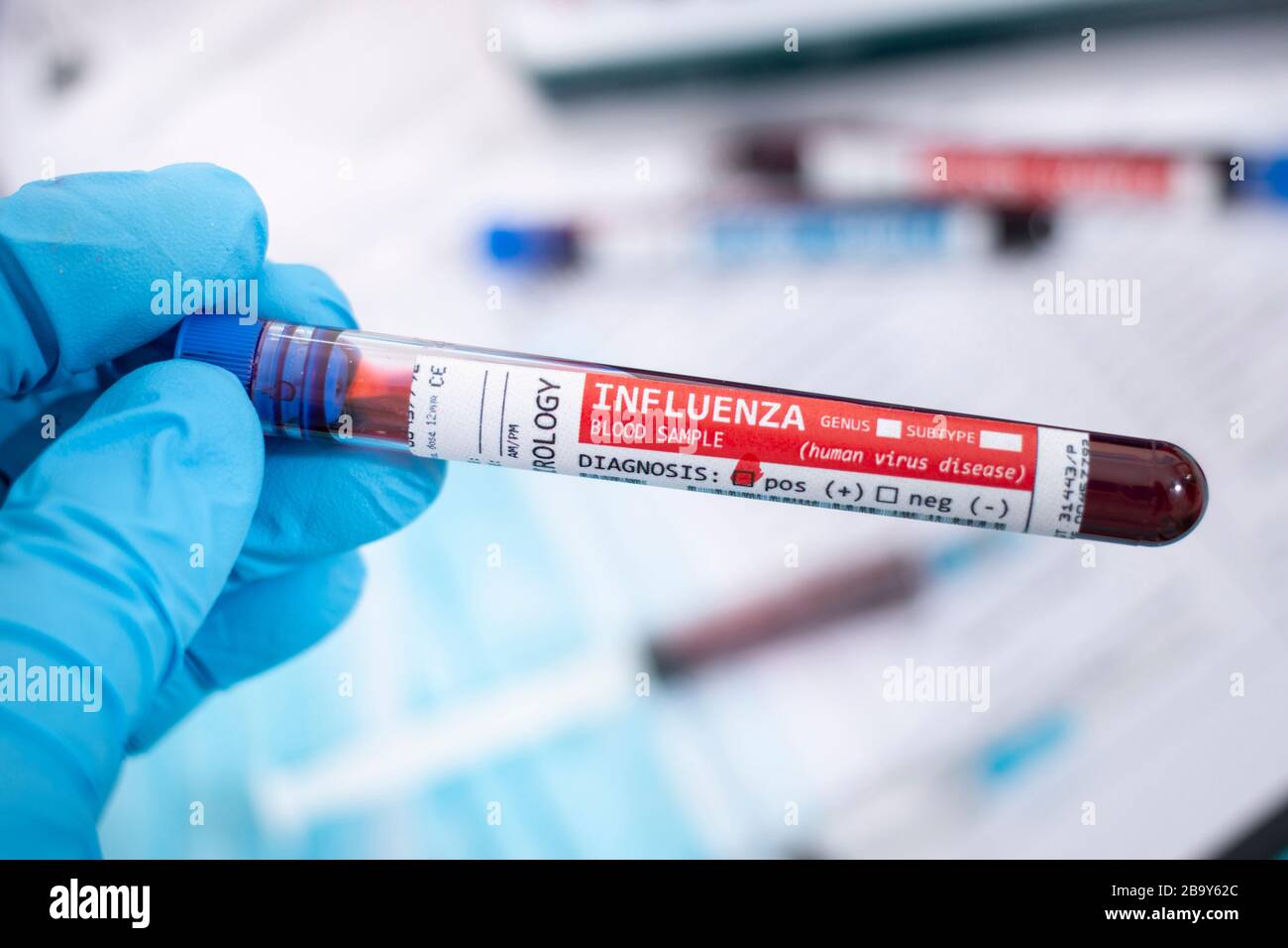 Fictional Blood samples with infected human influenza virus, with ...