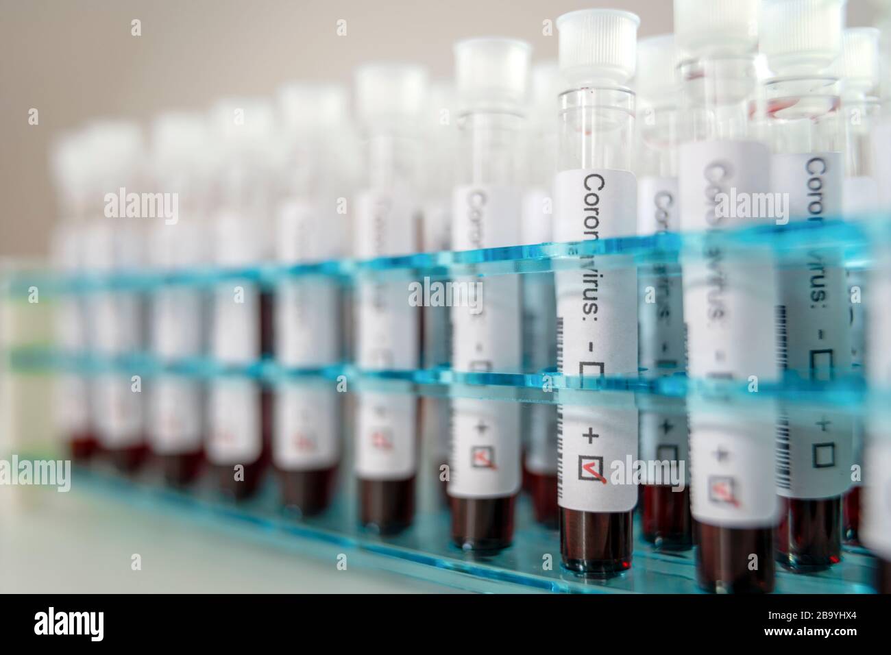 Positive results of corona virus tests. Many blood test tube in special ...