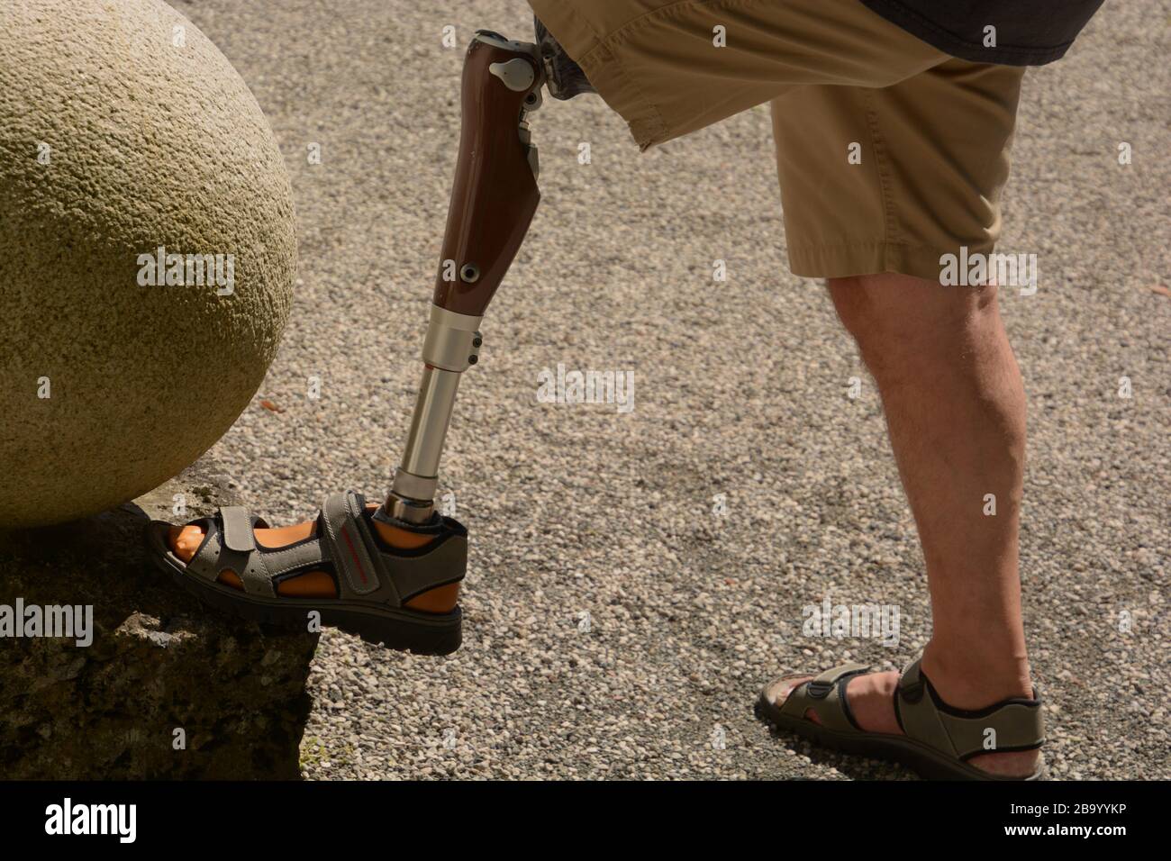 bionic carbon leg prosthesis of a man, left leg prosthesis self-assured ...