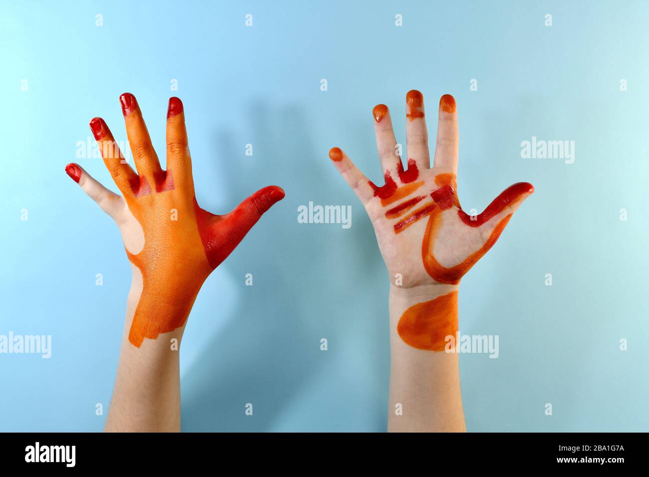 Two hands on the back of the palm and palm. The red zone of heavy ...