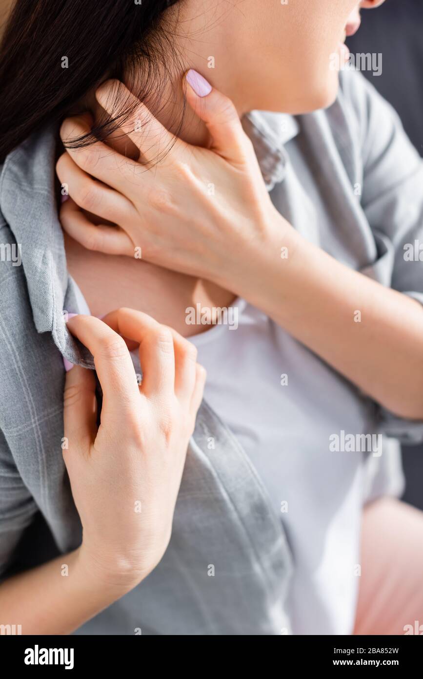 Woman scratching hi-res stock photography and images - Alamy