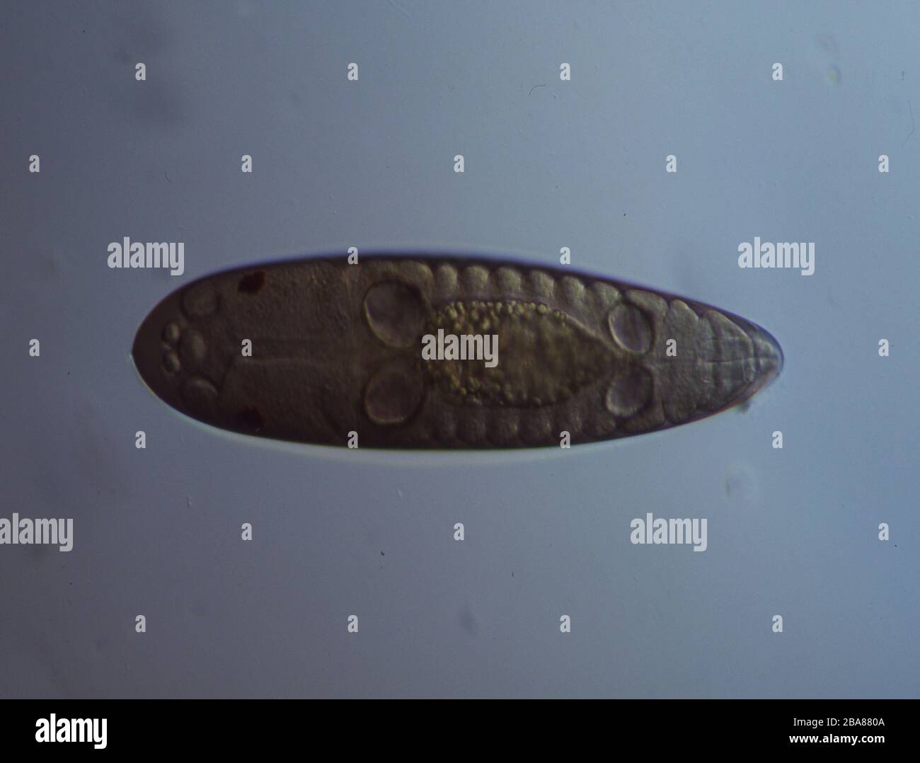 Mosquito egg in water under the microscope 100x Stock Photo - Alamy