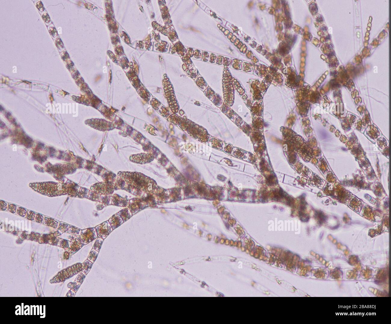 Red algae cells hi-res stock photography and images - Alamy