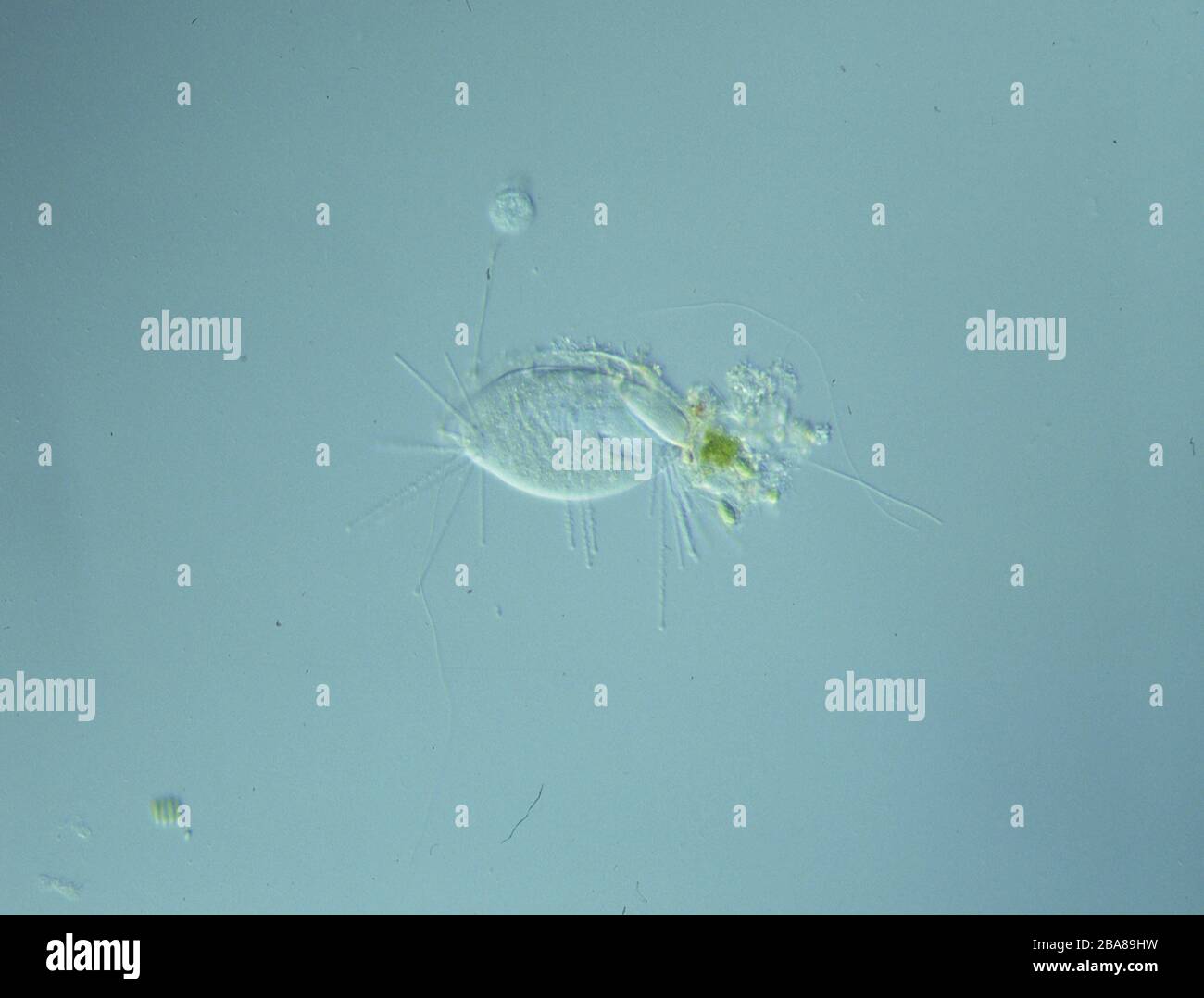 Ciliates in drops of water under the microscope 100x Stock Photo - Alamy
