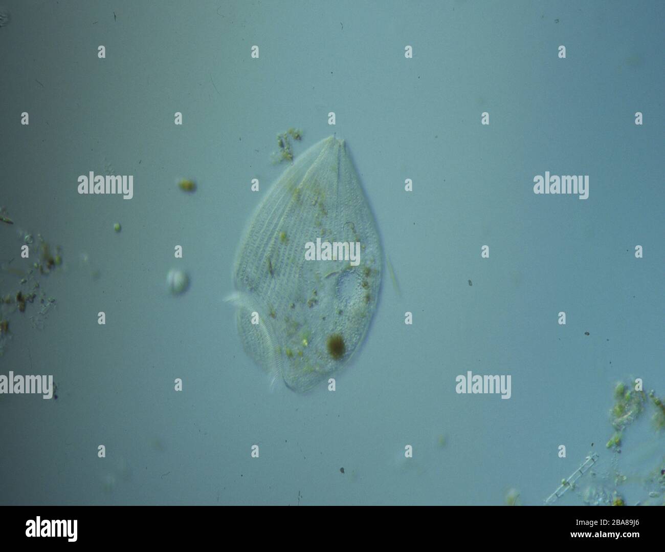 Ciliates Under Microscope