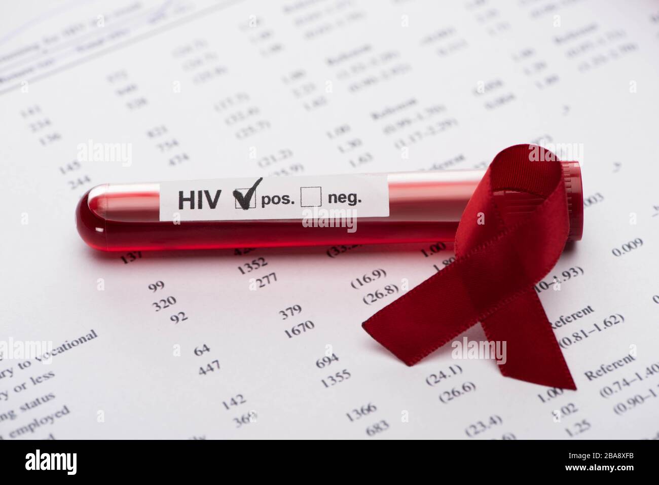positive hiv blood sample test on paper result form with awareness ...