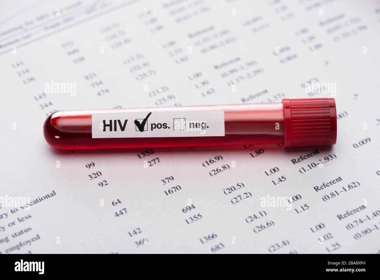 positive hiv blood sample test on paper result form Stock Photo - Alamy