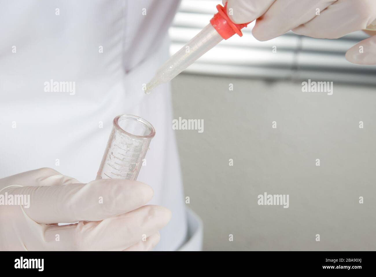 coronavirus covid-19 infected blood sample in sample tube chemistry ...