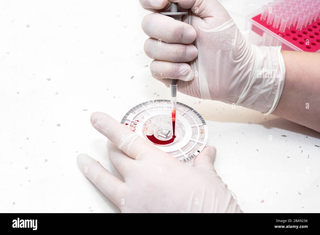 Close up view of laboratory equipment. Blood contaminated by ...