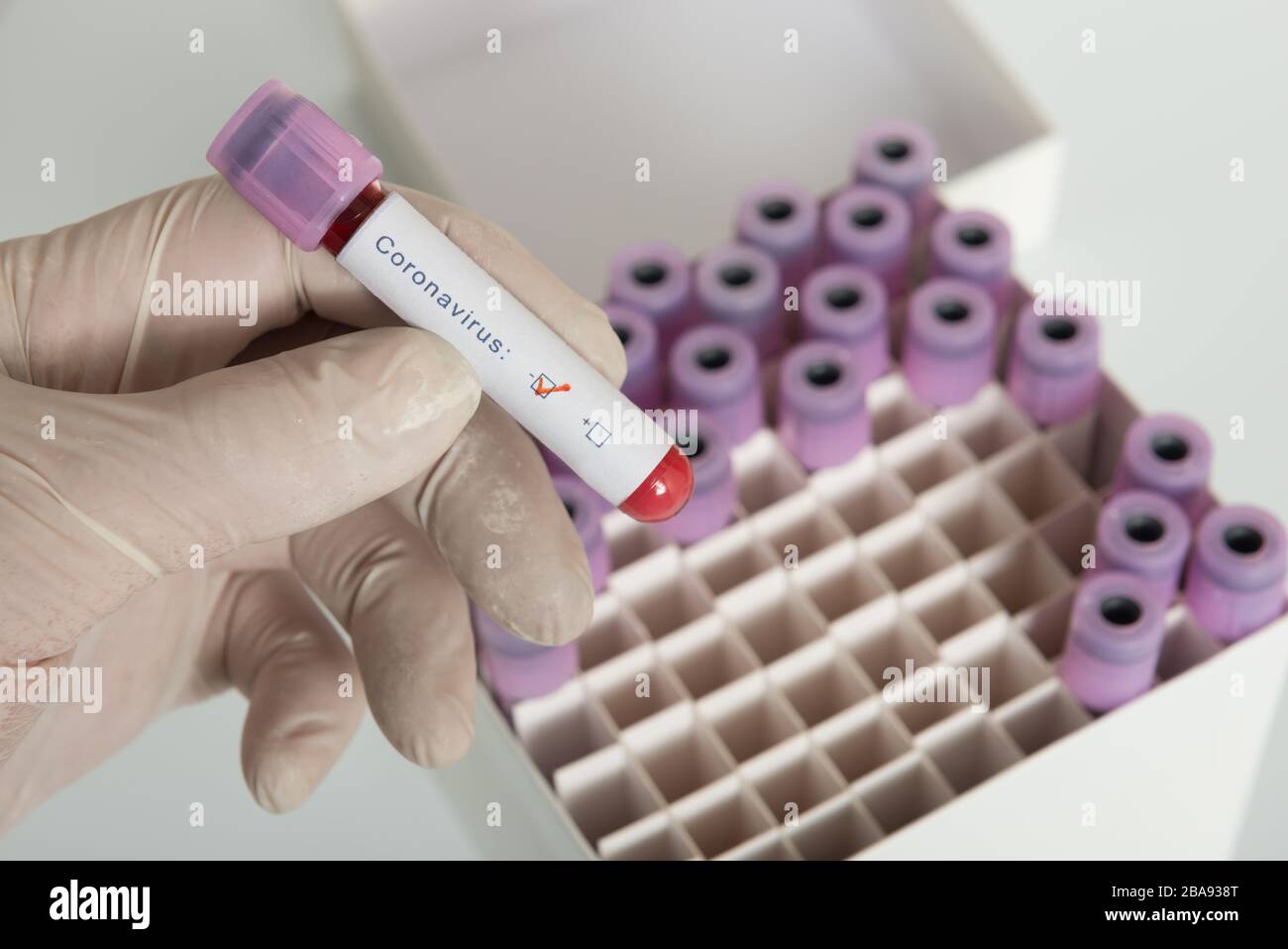 Test results of infectious viral pandemic, coronavirus, showing ...