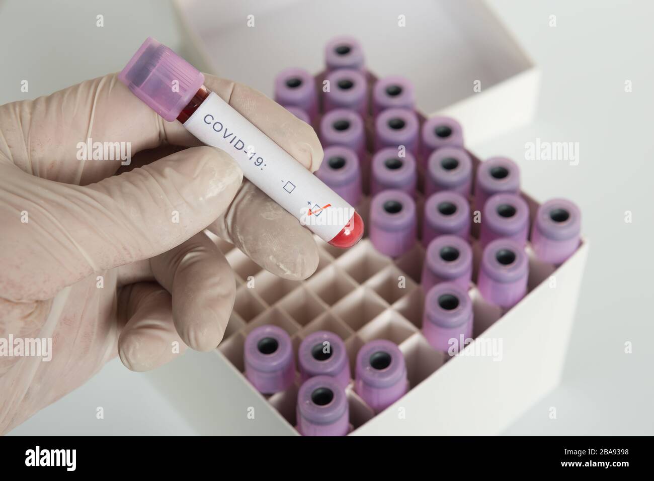 Test results of infectious viral pandemic, coronavirus, showing ...