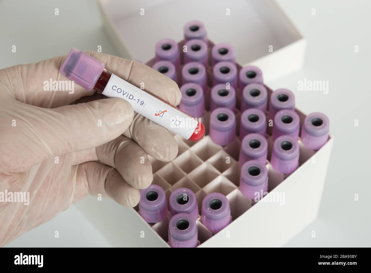Test results of infectious viral pandemic, coronavirus, showing ...