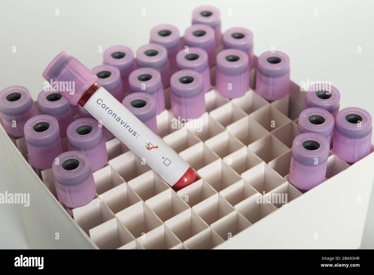 Test results of infectious viral pandemic, coronavirus, showing ...