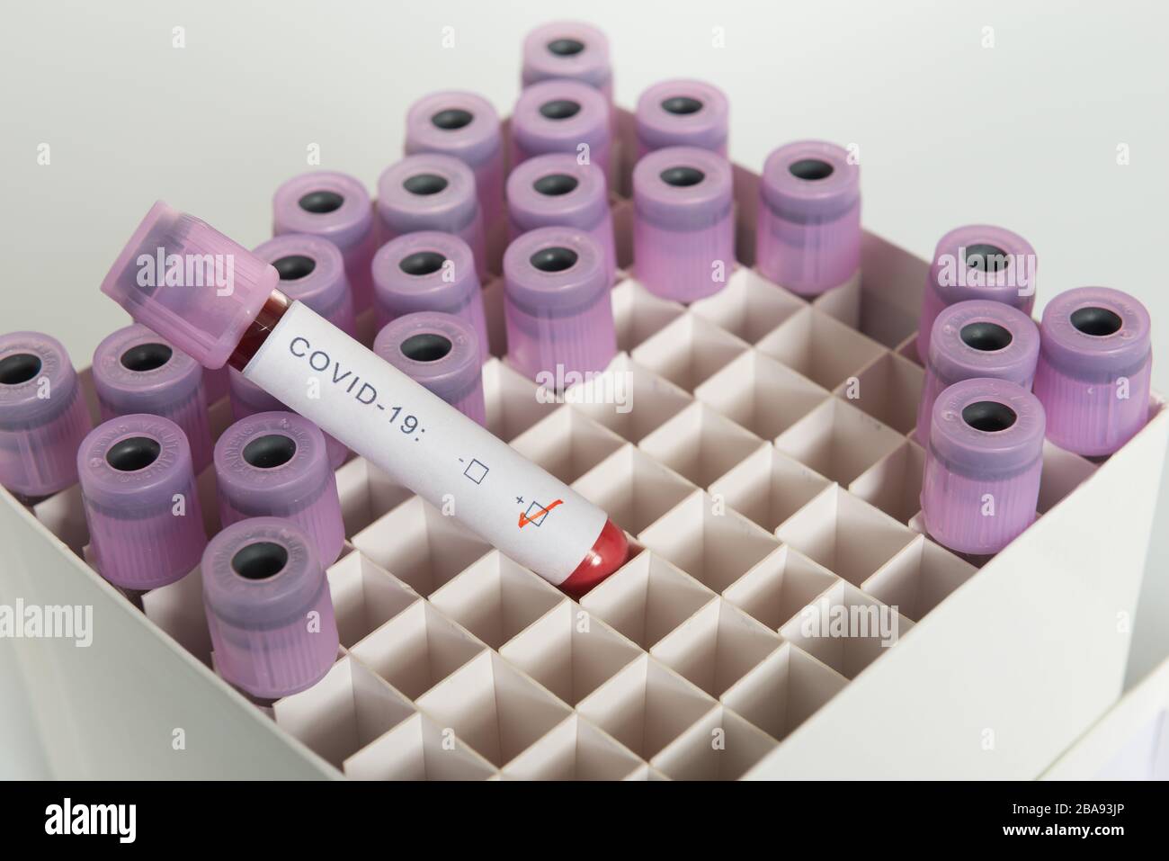 Test results of infectious viral pandemic, coronavirus, showing ...
