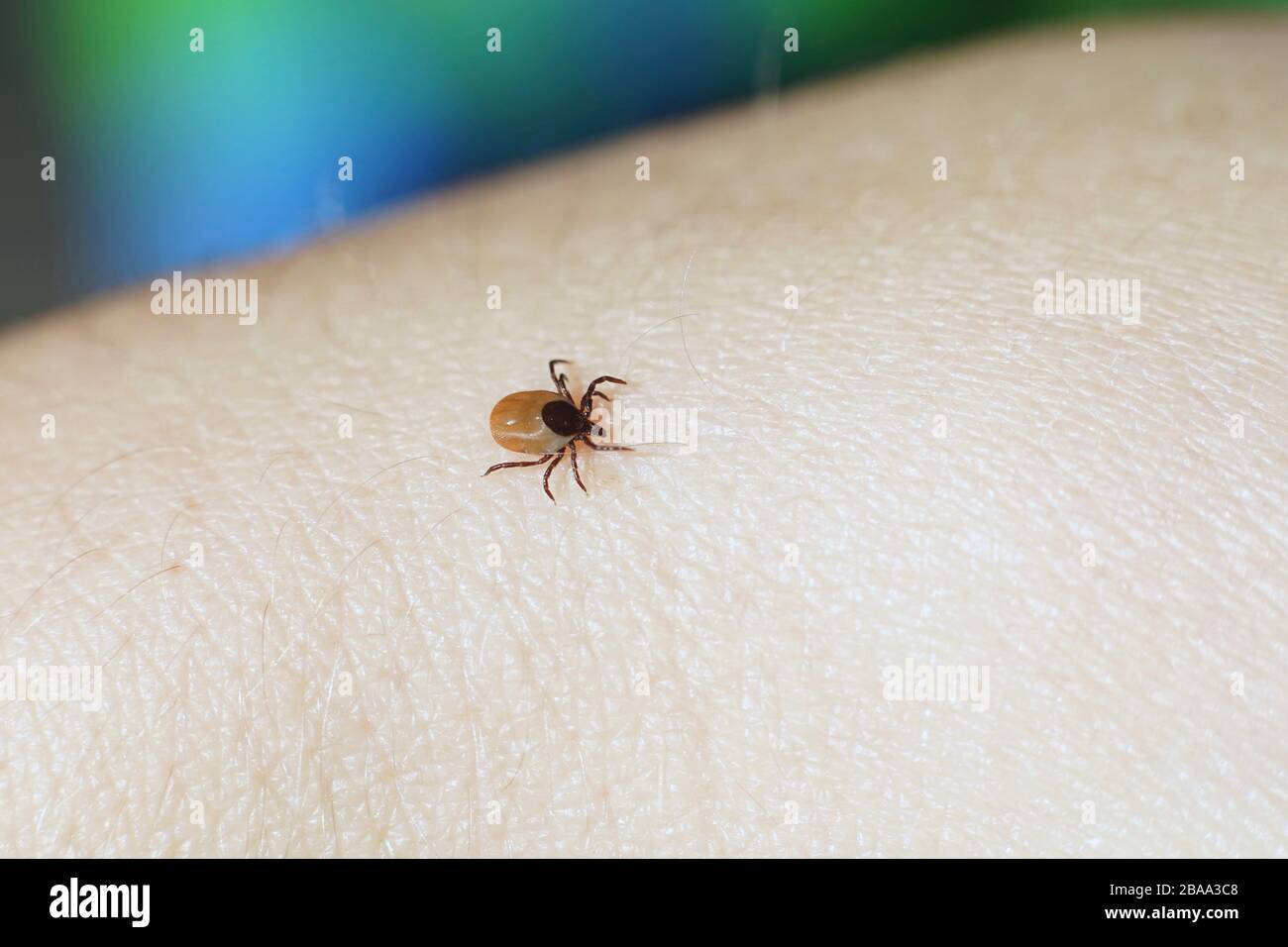 Black legged tick on skin hi-res stock photography and images - Alamy