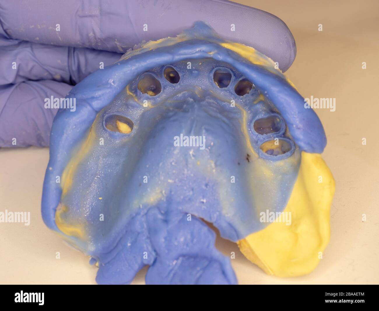 Jaws and teeth pliable imprint in a dental laboratory for the ...