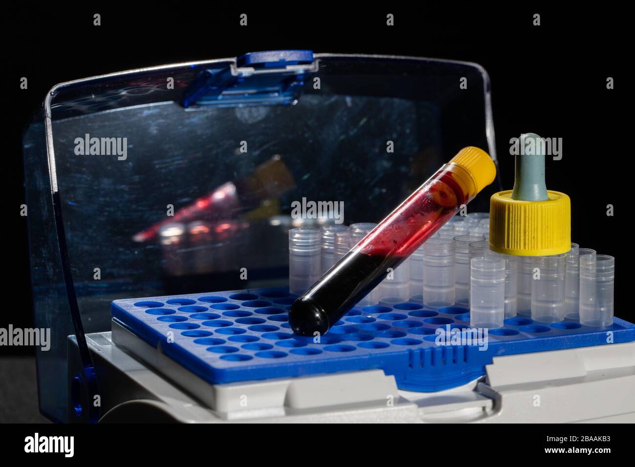 Each blood vial is transported to the laboratory for specialized tests ...
