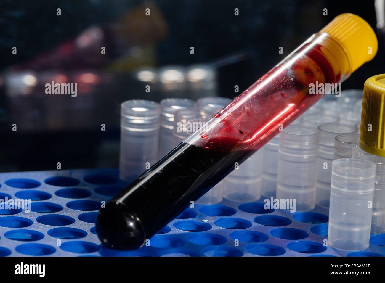 Each blood vial is transported to the laboratory for specialized tests ...