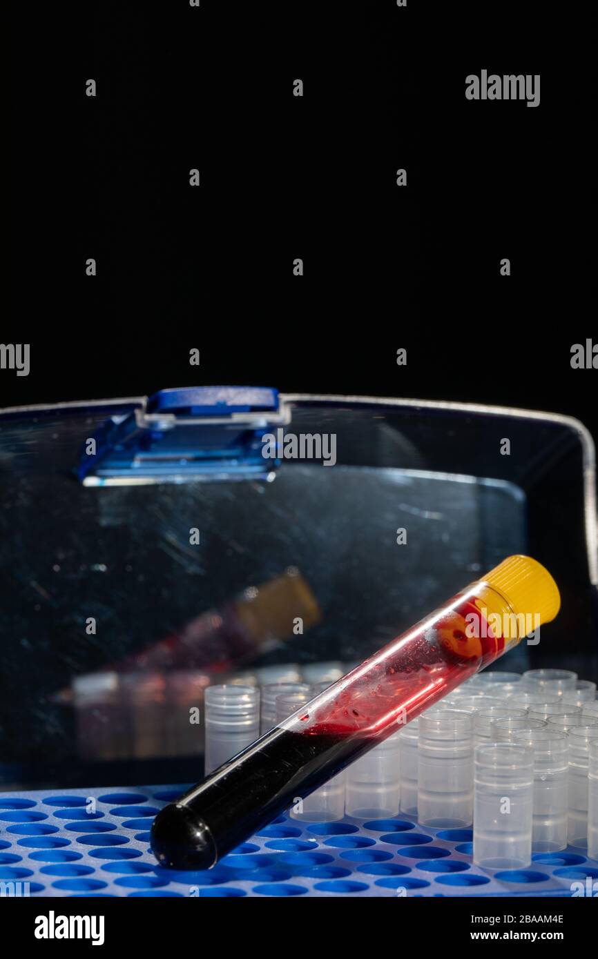 Yellow blood collection tube hi-res stock photography and images - Alamy