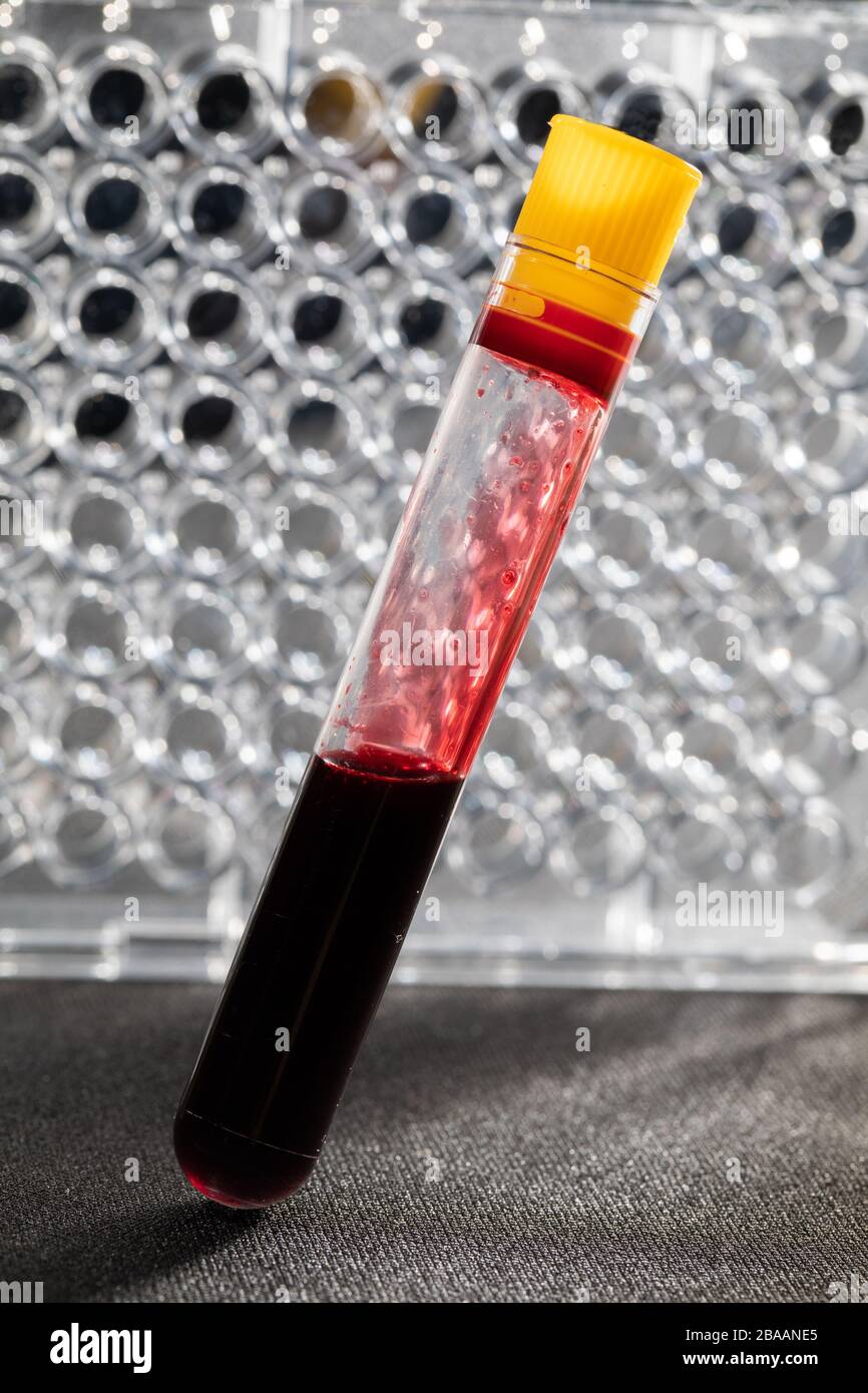 Each blood vial is transported to the laboratory for specialized tests ...