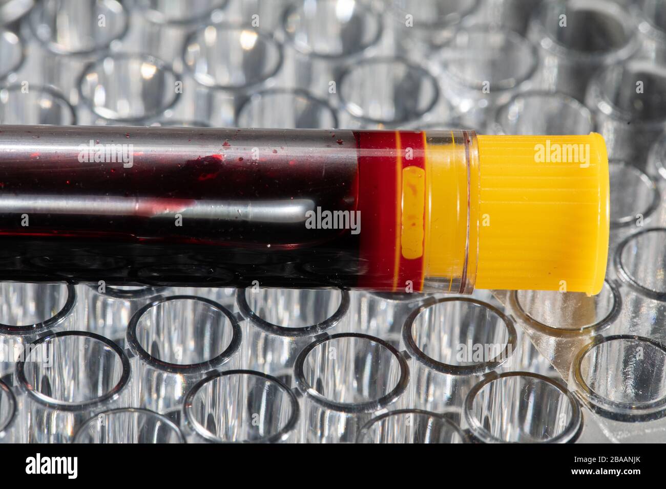 Each blood vial is transported to the laboratory for specialized tests ...