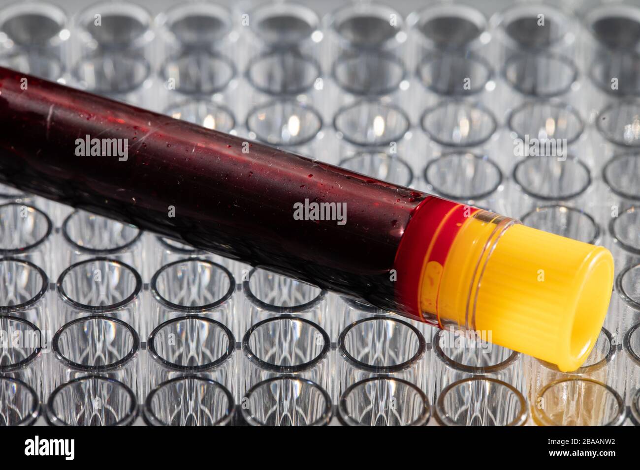 Each blood vial is transported to the laboratory for specialized tests ...