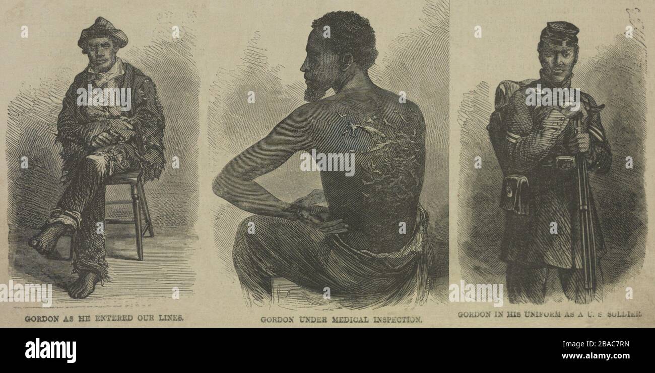 Escaped slave Gordon, whose scarred back from whipping is evidence of ...