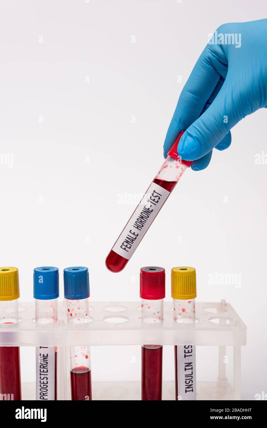 Progesterone hormone test hi-res stock photography and images - Alamy