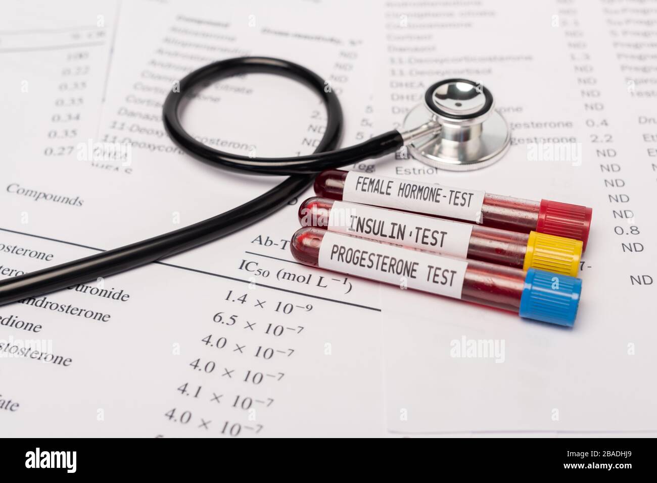 Close up view of test tubes with hormone and insulin tests of blood ...