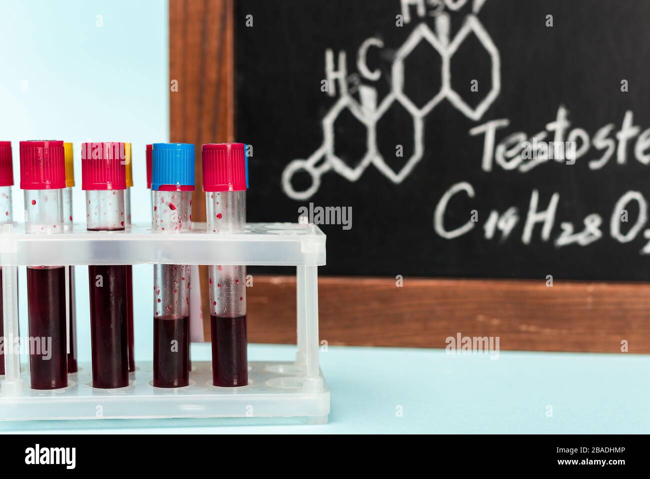 Testosterone test hi-res stock photography and images - Alamy