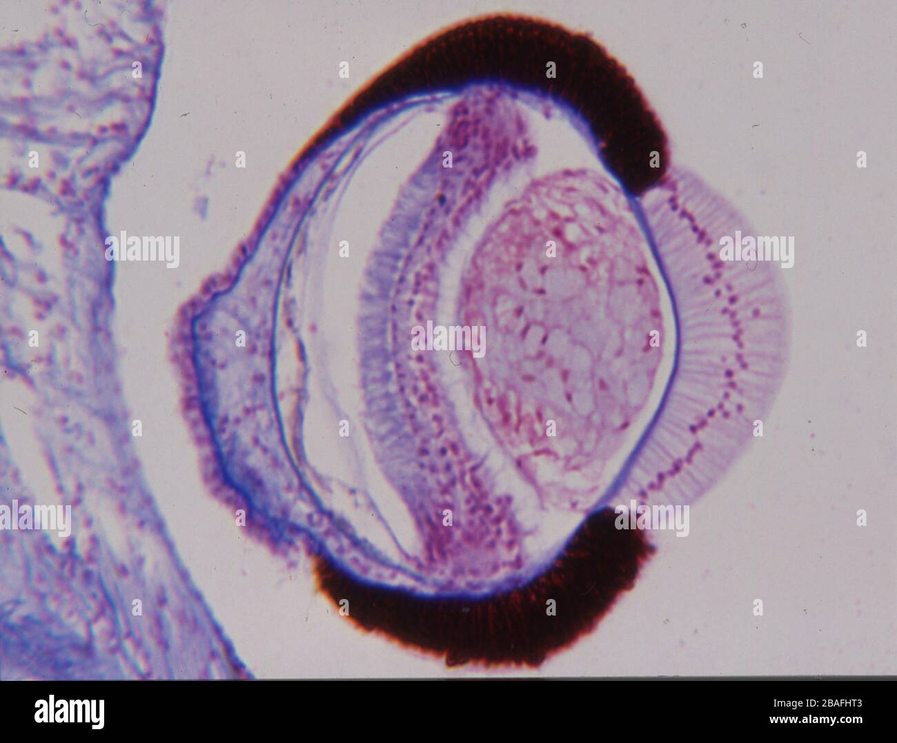 Eyeball in longitudinal section under the microscope 50x Stock Photo ...
