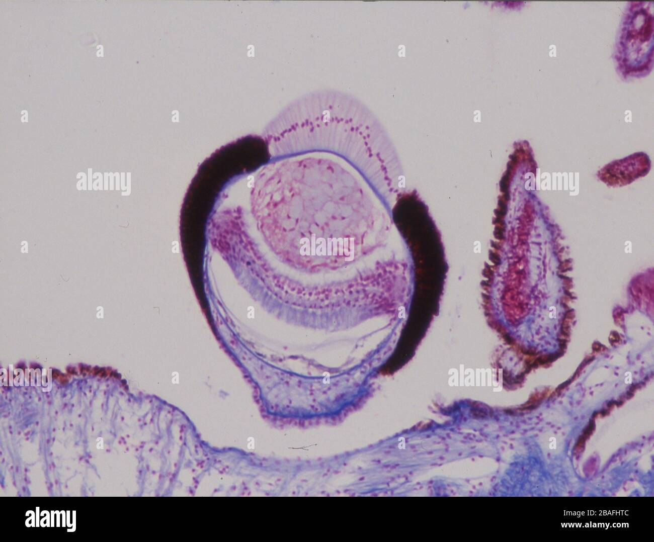 Eyeball in longitudinal section under the microscope 50x Stock Photo ...