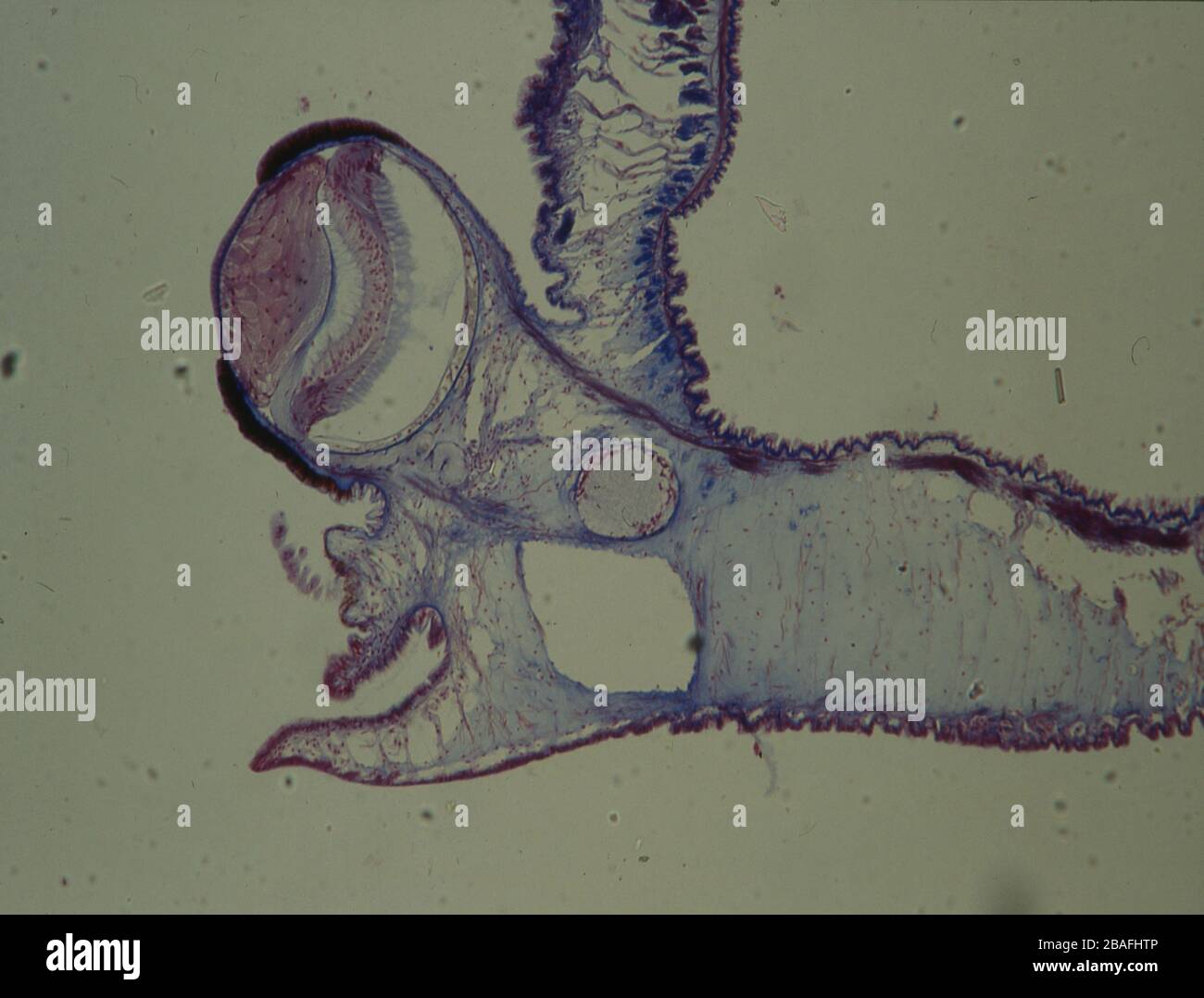 Eyeball in longitudinal section under the microscope 50x Stock Photo ...