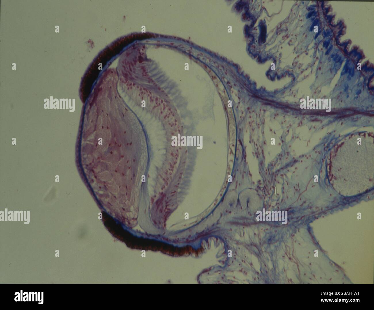 Eyeball in longitudinal section under the microscope 50x Stock Photo ...