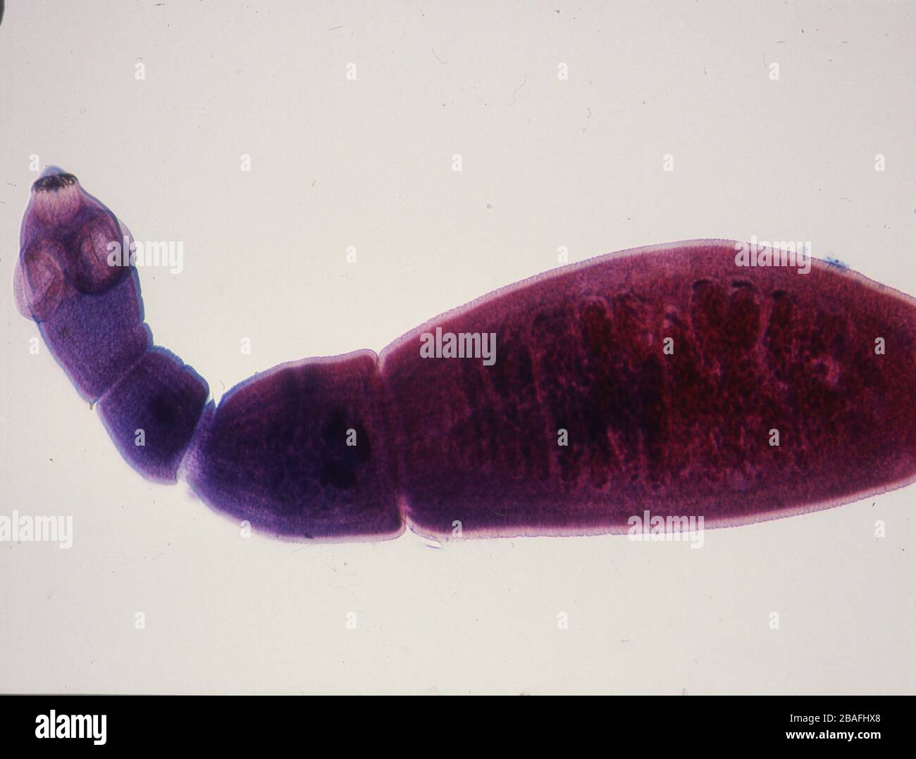 Cestoda hi-res stock photography and images - Alamy