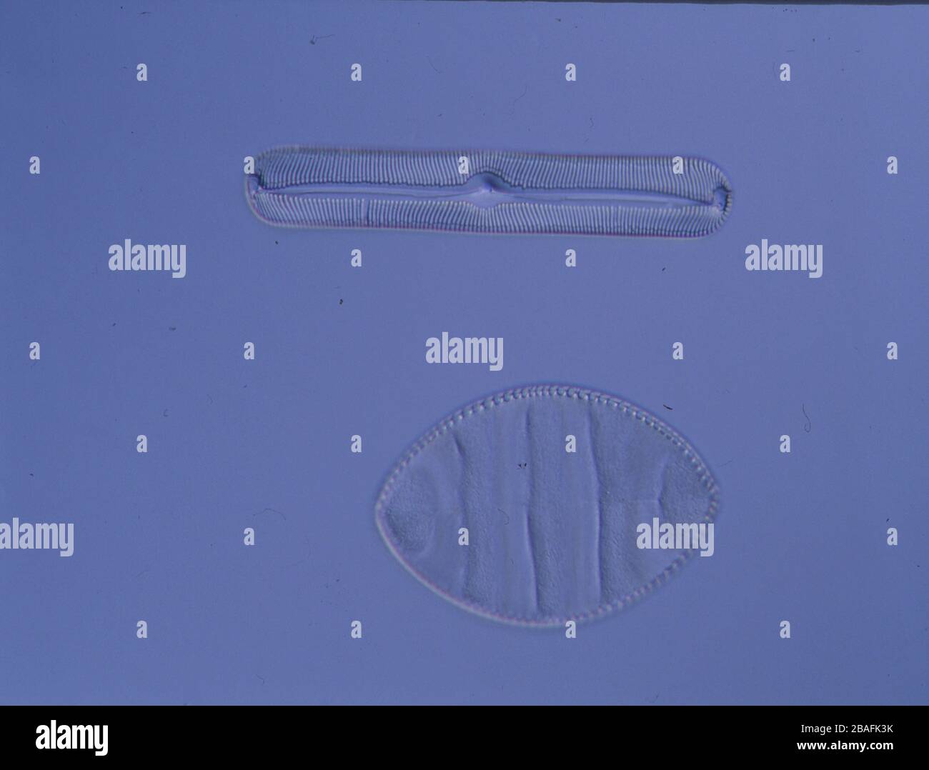Diatoms from the sea under the microscope 100x Stock Photo - Alamy