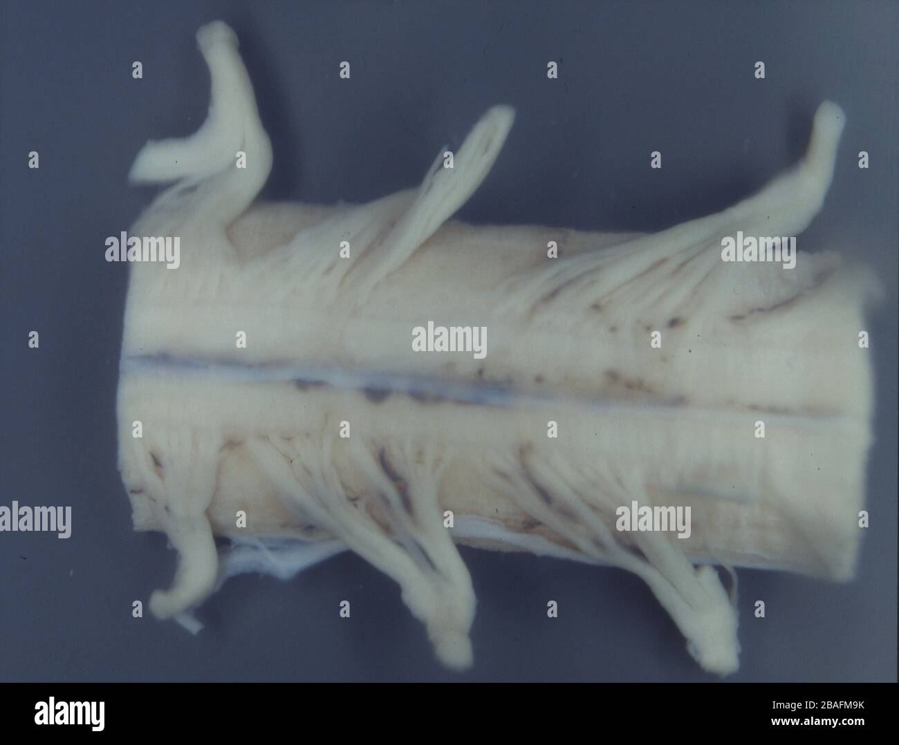 Frog nerve hi-res stock photography and images - Alamy